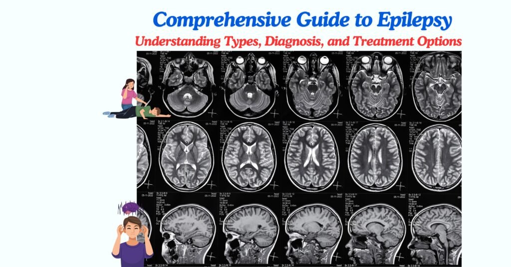 Comprehensive Guide to Epilepsy: Understanding Types, Diagnosis, and ...