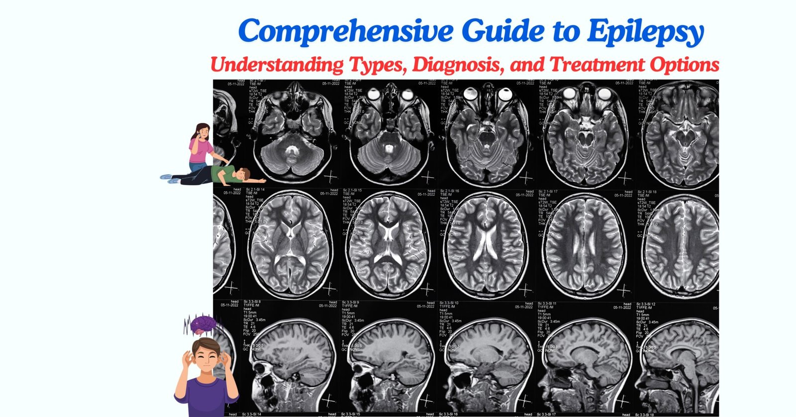 Comprehensive Guide to Epilepsy: Understanding Types, Diagnosis, and ...