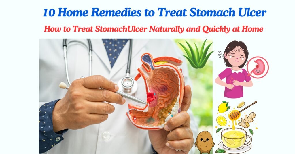How to treat a stomach ulcer at Home quickly - Medsparkles (SMC-Pvt ...